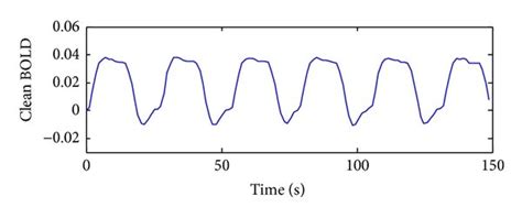 FMRI Synthetic Data Synthesis Against A Periodic Stimulus S F V Download Scientific