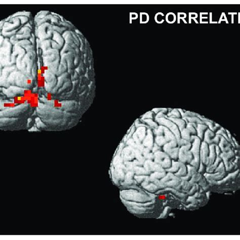 Pd Correlation With The Contrast Perceived Happiness Vs Perceived