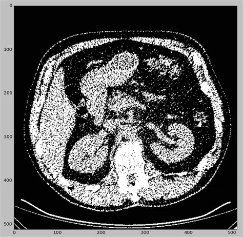 Medical Imaging Python Read And Convert Raw D Image File Stack Overflow