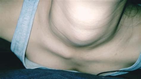 Visible Cervical Artery And Heartbeat Sound