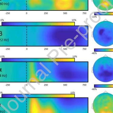 A Whole Brain Correlation Map Showing The Significant Relationship