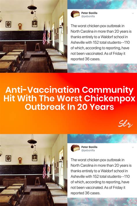 Anti Vaccination Community Hit With The Worst Chickenpox Outbreak In 20