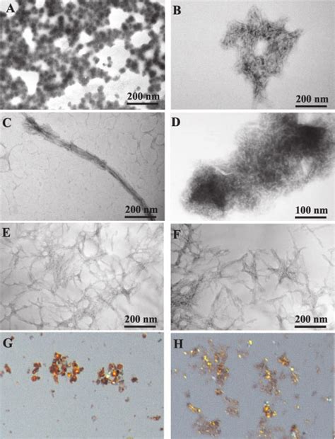 Micrographs Of Iapp Aggregates Af Electron Micrographs Of Iapp
