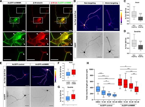Figures And Data In The Non Mitotic Role Of Hmmr In Regulating The