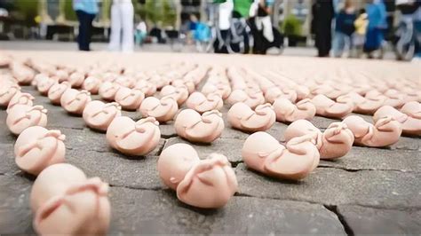 人工流产的胎儿最终去哪了？看完这几种处理方式，还想打胎吗？【老山的情感生活】 Youtube