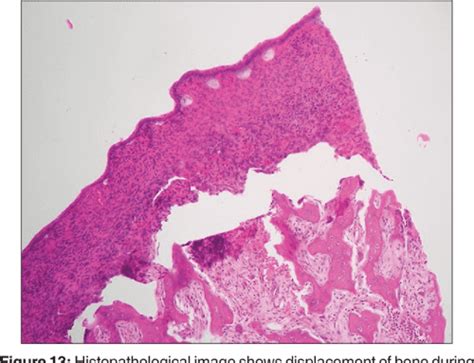 Figure 18 From A Review Of Artifacts In Histopathology Semantic Scholar