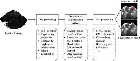 Systematic Pipeline Of Instrument Detection In Us Image First The
