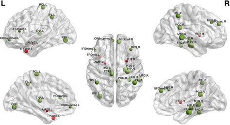 Brain Glass‐surface Representation Of The Partial Least Squares Download Scientific Diagram