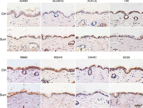 Immunohistochemical Localization Of The Eight Makers In Mice Skin