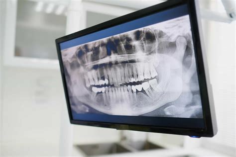 Can Braces Fix Your Jaw Alignment My Smile Orthodontist