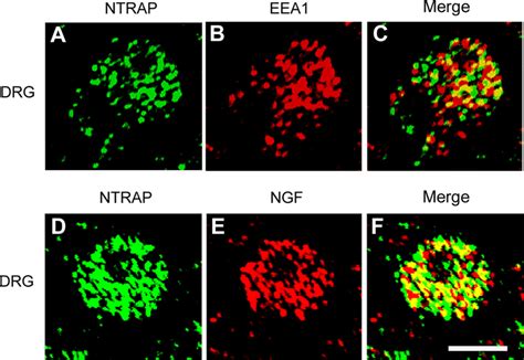 Colocalization Of Ntrap With Signaling Endosome Markers In Drg Neurons
