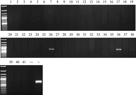Mfge8 Cre Founders Newborn Mice Derived From Pronuclear Injection Of