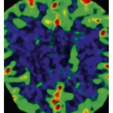 Improved Deep Learning Deconvolution Network Model Download