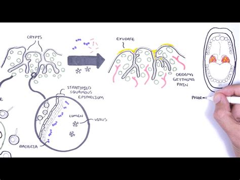 Tonsil Crypt Anatomy