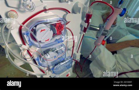 Hemodialysis Procedure Stock Videos Footage HD And K Video Clips Alamy