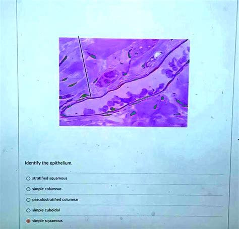 Solved Texts Identify The Epithelium Stratified Squamous Simple Columnar