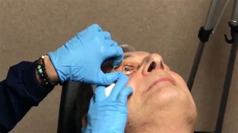 Liquid Eylea Aflibercept Injection For Hospital 40mg At ₹ 43000 Box In New Delhi