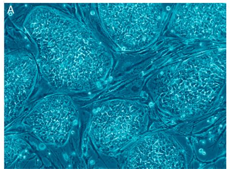 Nad And The Hallmarks Of Aging Series Part 8 Stem Cell Exhaustion