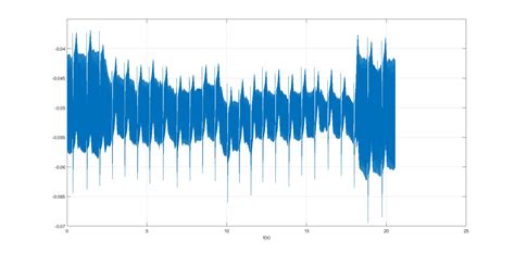 Ads1292r Huge Noise In The Original Ecg Signal Acquired Data Converters Forum Data