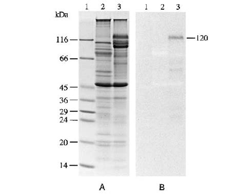 Detection Of Cry1ac Toxin Binding Proteins In Manduca Sexta Midgut