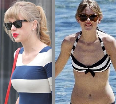 Taylor Swift Plastic Surgery