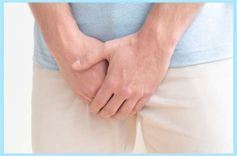 남성 곤지름 증상 치료 관리하기 네이버 블로그