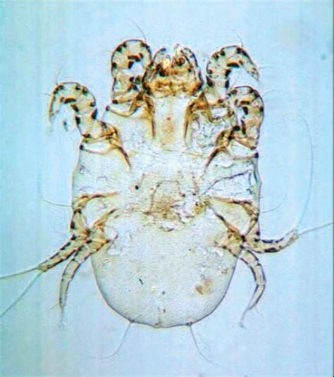 Sarcoptic Mange Mite