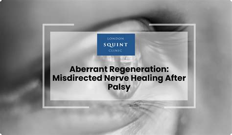 Aberrant Regeneration Misdirected Nerve Healing After Palsy The