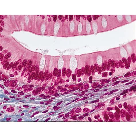 Identify The Primary Function Of Simple Columnar Epithelium At Thomas