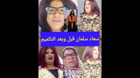 الفنانة سعاد سلمان قبل وبعد عملية التكميم Youtube