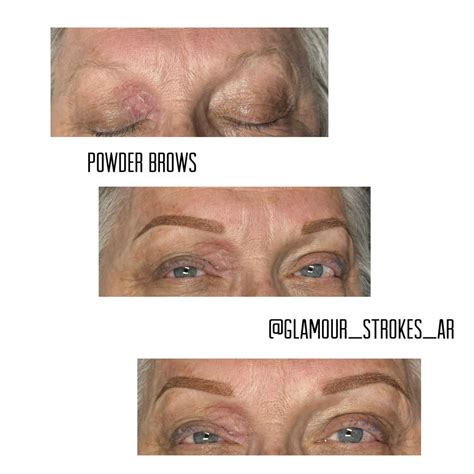 Glamour Strokes By Alex Check Out This Transformation Bottom Pic Is Final Procedure After