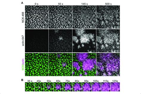 Actin Polymerization From Phase Separated Clusters A Total