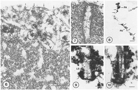 High Magnification Thin Section Electron Micrographs Of Pachytene Download Scientific Diagram