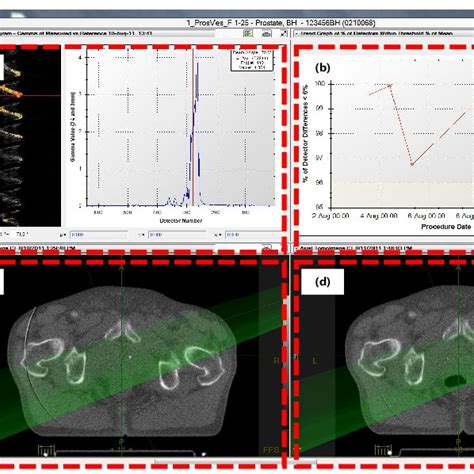 Example Of Analysis Result By In Treatment Assessment A Detector Download Scientific Diagram