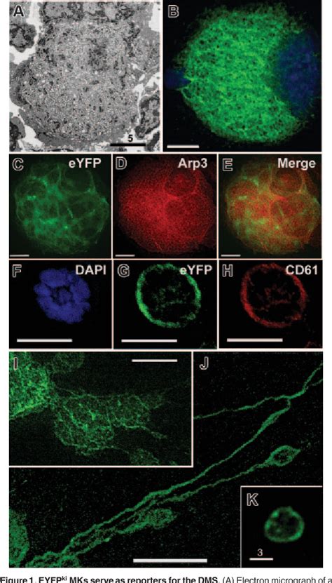 Figure 1 From Characterization Of The Megakaryocyte Demarcation Membrane System And Its Role In
