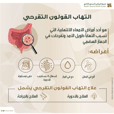 ما أعراض التهاب القولون التقرحي؟ الصحة والغذاء