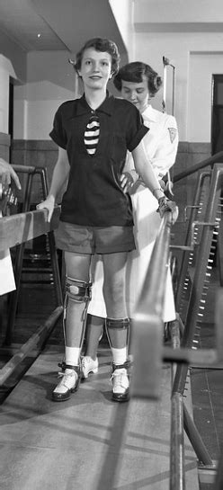 Woman Amputee Polio Porn Telegraph