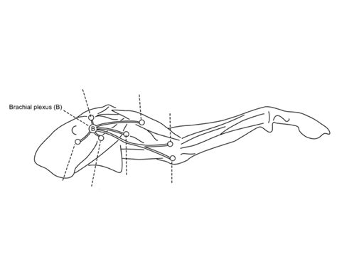Brachial Plexus Nerves Of Forelimb — Printable Worksheet