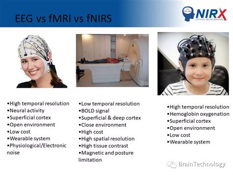 Eeg Vs Mri Vs Fmri Vs Fnirs 长擎科技
