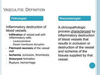 Vasculitis Pptx