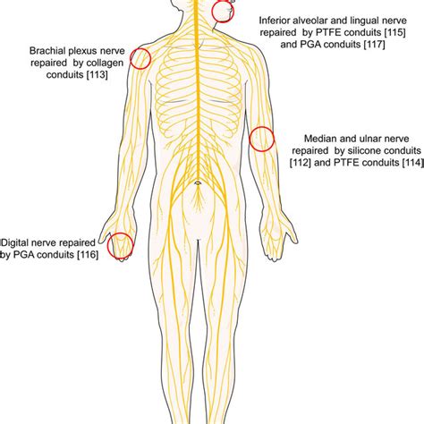 Schematic Illustration Of Peripheral Nerve Repair Strategies Via
