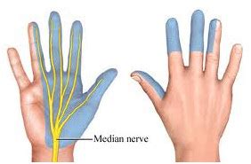Carpal Tunnel Syndrome Or Cervical Radiculopathy EMG Testing Can Provide The Answer EMG Test