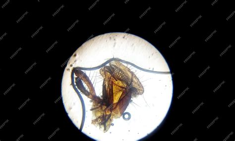 Premium Photo Close Up Of Insects On Microscope Against Black Background