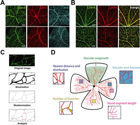 Visualization And Image Processing Of Retinal Vasculature A