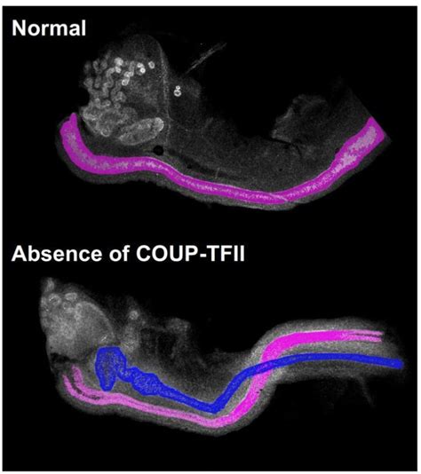NIH Study Shows How Sex Specific Reproductive Systems Arise UPI Com