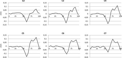 Spinal Cord Motion In Each Cervical Segment During One Heartcycle Download Scientific Diagram