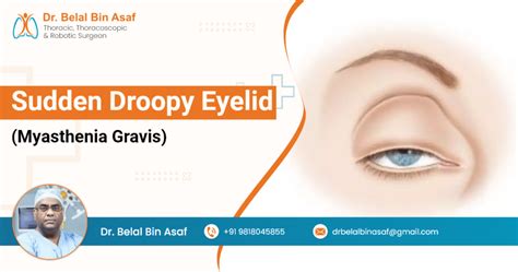 Sudden Droopy Eyelid Caused By Myasthenia Gravis