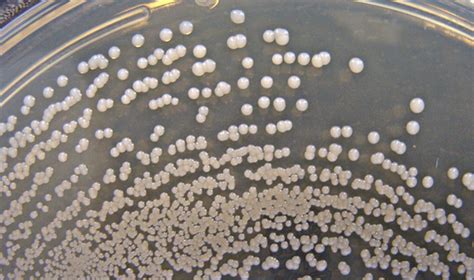 Genus Microbiology