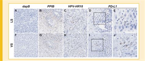 Automated Rnascope Ish Assay Detects High Target Signal With Low