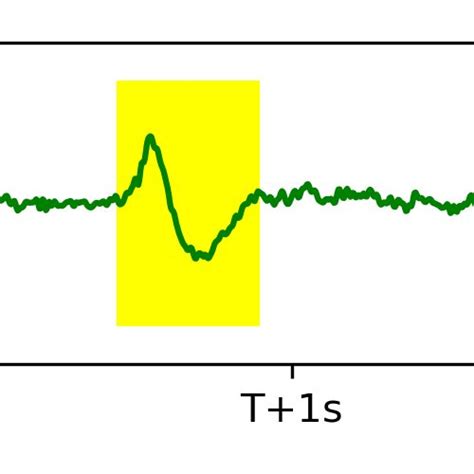preprocessing procedure a a 2 s raw eeg signal segment example where